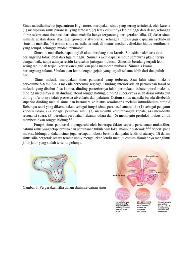 Sinus Maksila Disebut Juga Antrum High More | PDF