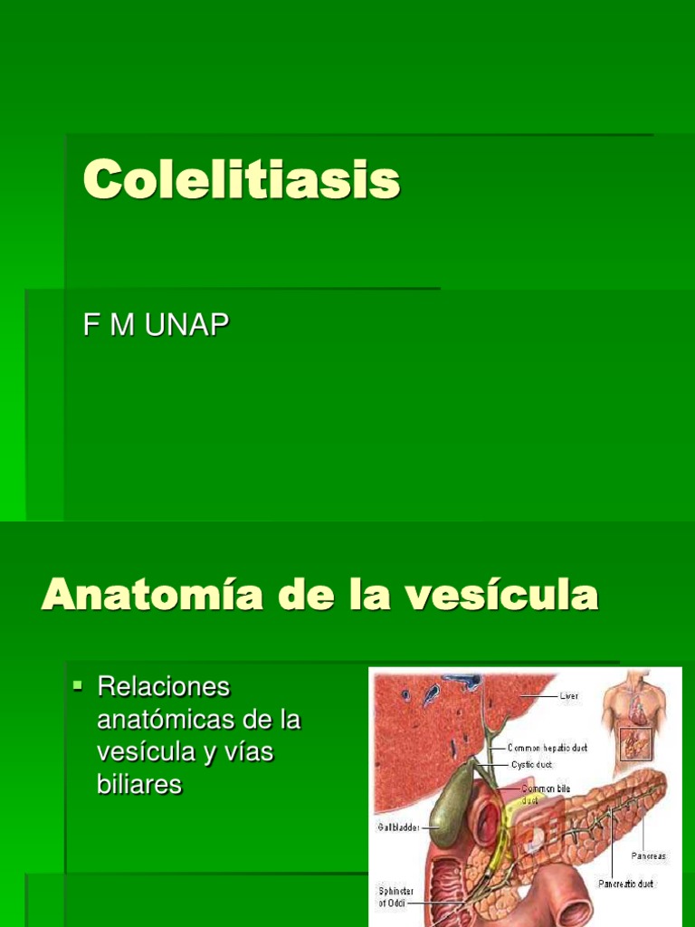 Colelitiasis | PDF | Vesícula biliar | Enfermedades digestivas
