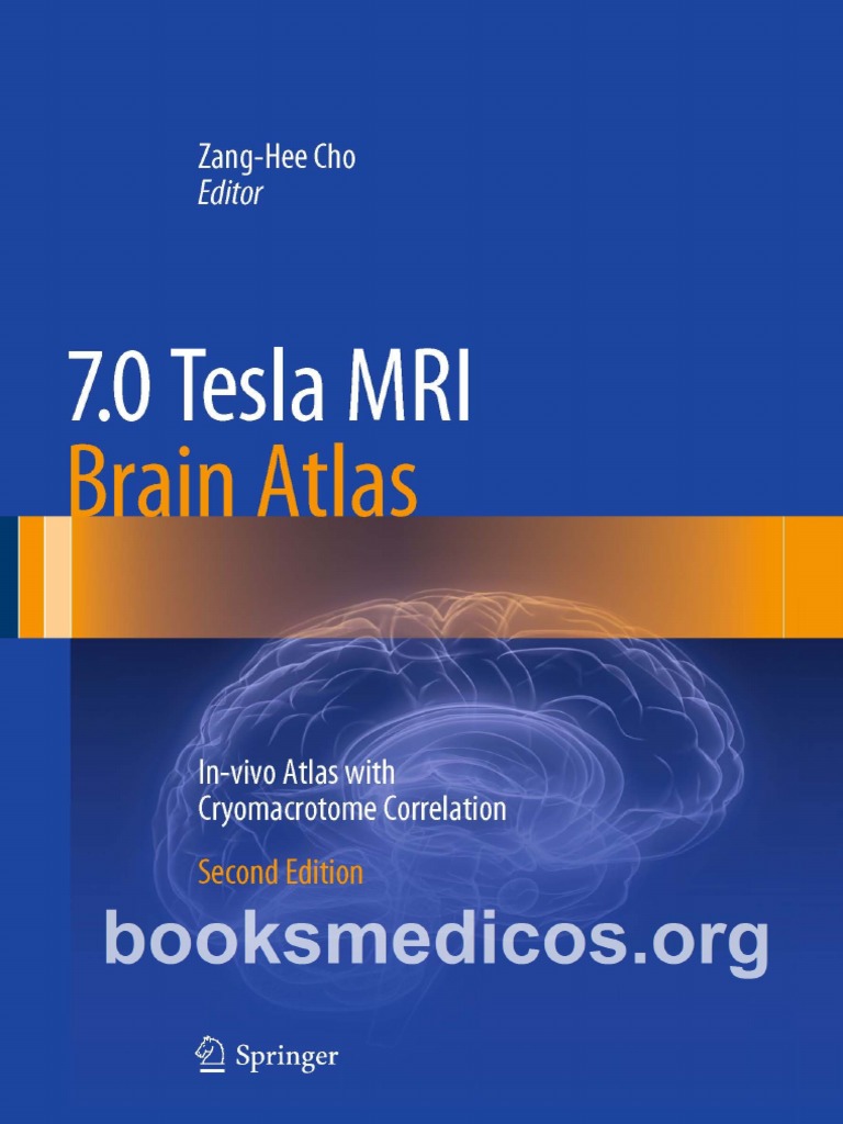 7.0 Tesla MRI Brain Atlas | PDF | Medical Imaging | Magnetic Resonance ...