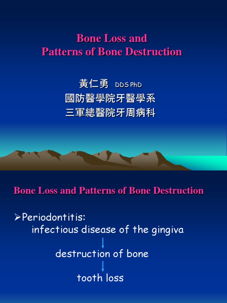 Bone Loss and Patterns of Bone Destruction: Dds PHD | PDF ...