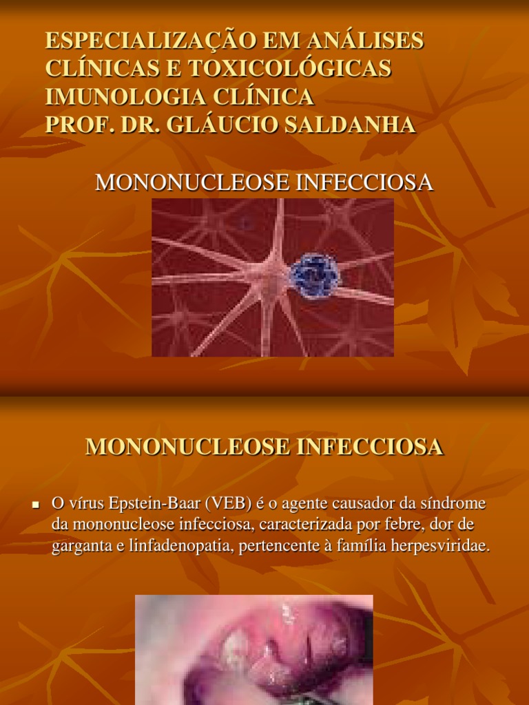 Mononucleose Infecciosa | PDF | Anticorpo | HIV/AIDS