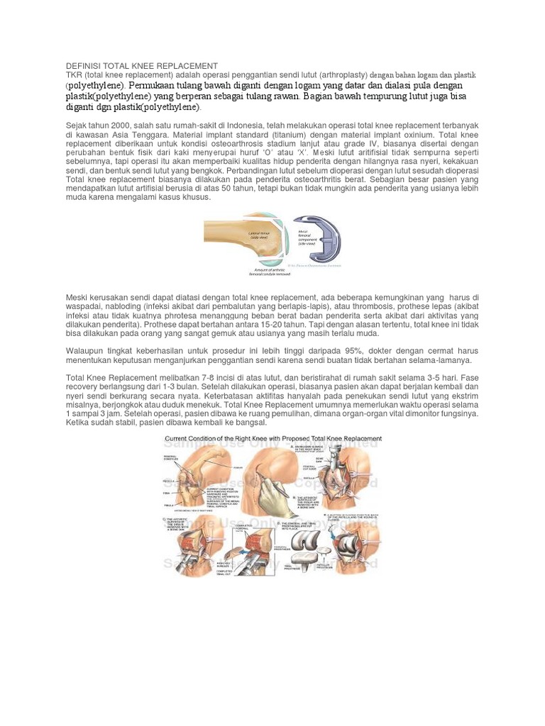 Manajemen Total Knee Replacement Pdf