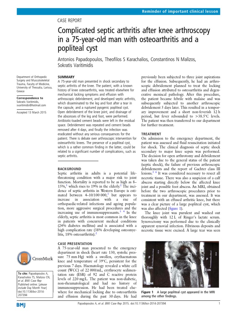 Complicated Septic Arthritis After Knee Arthroscopy in A 75-Year-Old ...