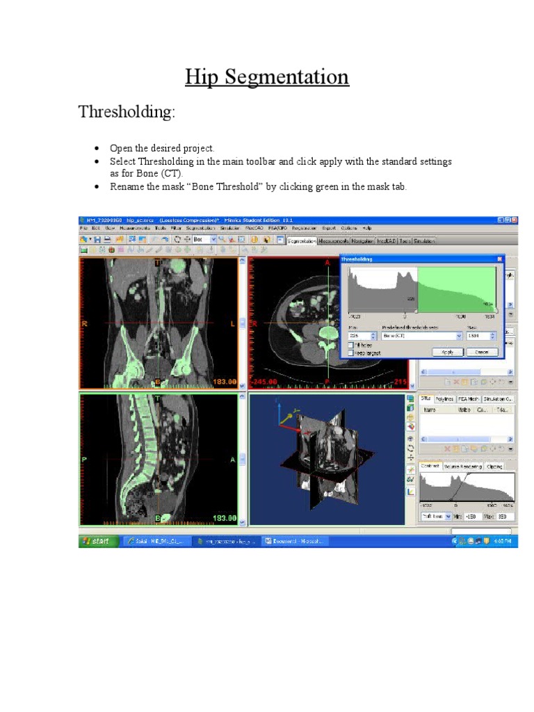 Hip Segmentation Techniques Guide | PDF | 3 D Modeling | Image Segmentation