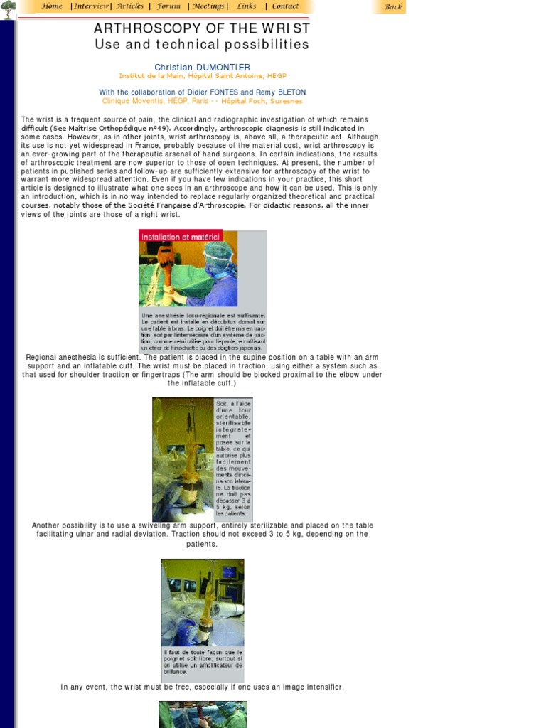 CPT Code for Scapholunate Repair | PDF | Human Anatomy | Skeletal System