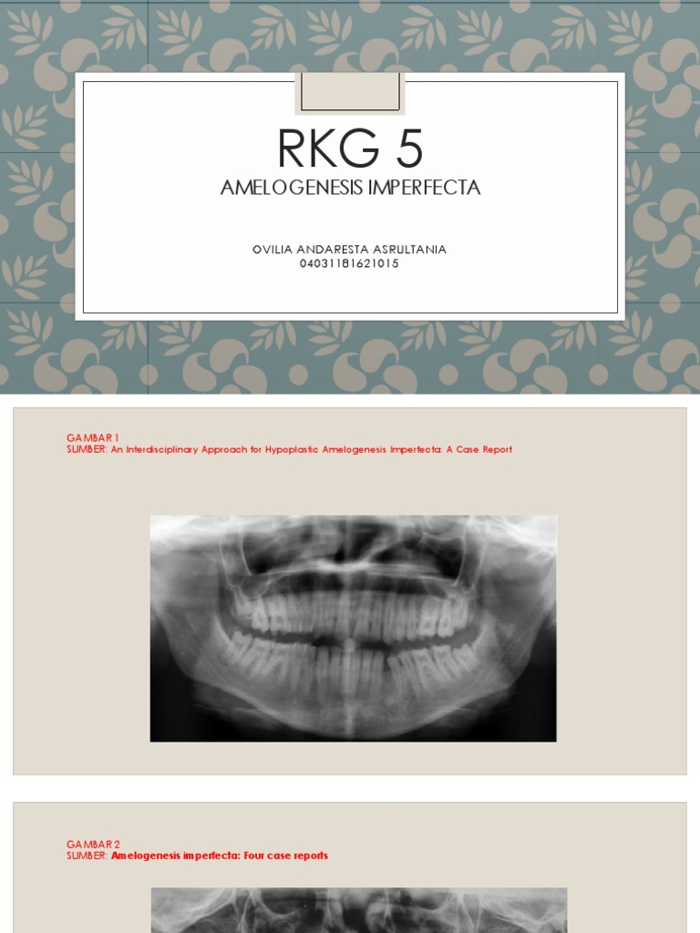 RKG 5 | PDF