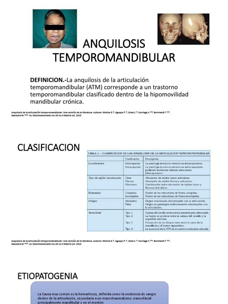 Anquilosis | PDF | Enfermedades y trastornos | Especialidades Medicas