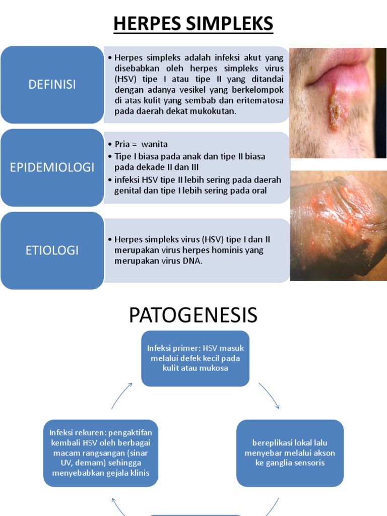 Panduan Herpes Simpleks | PDF