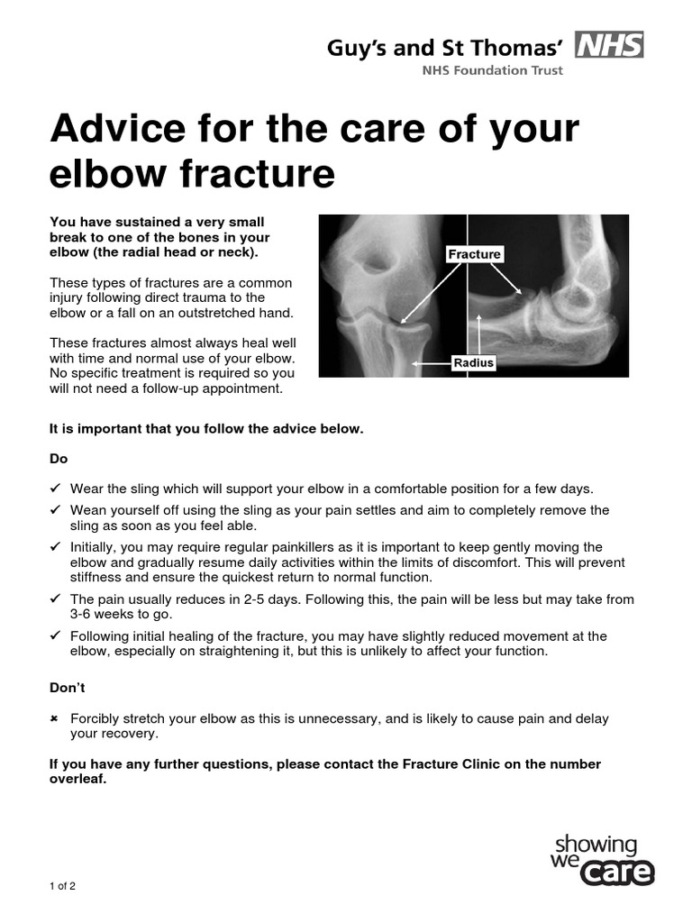 Advice For Care of Elbow Fractures | PDF | Elbow | National Health Service