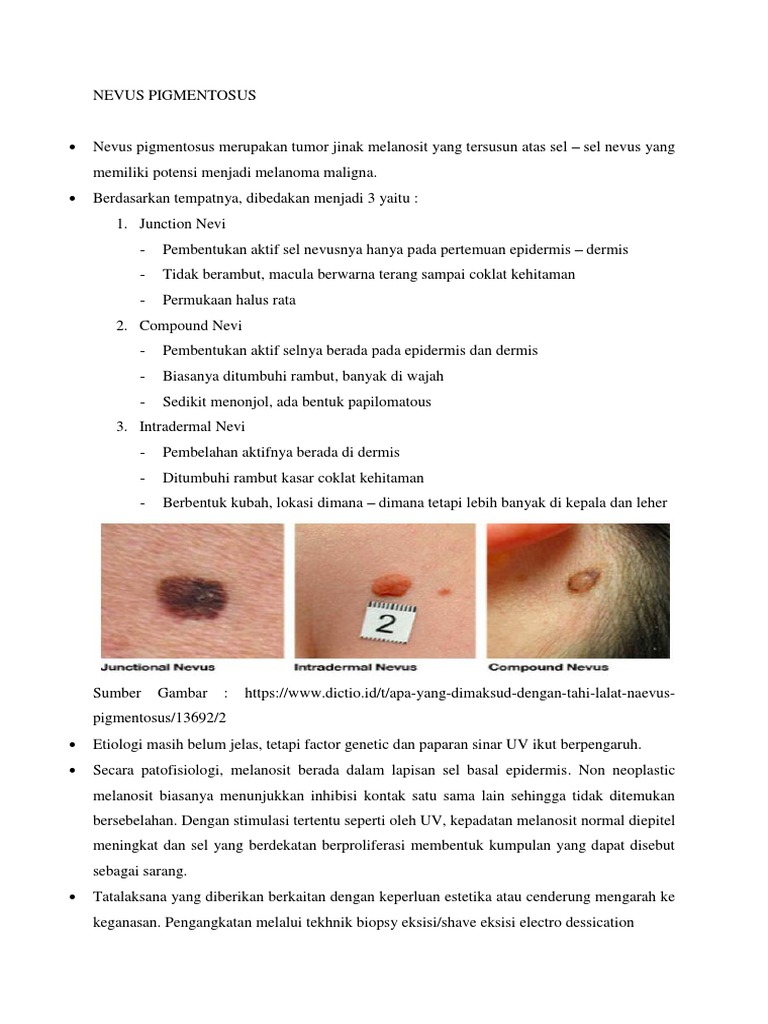 Nevus Pigmentosus | PDF