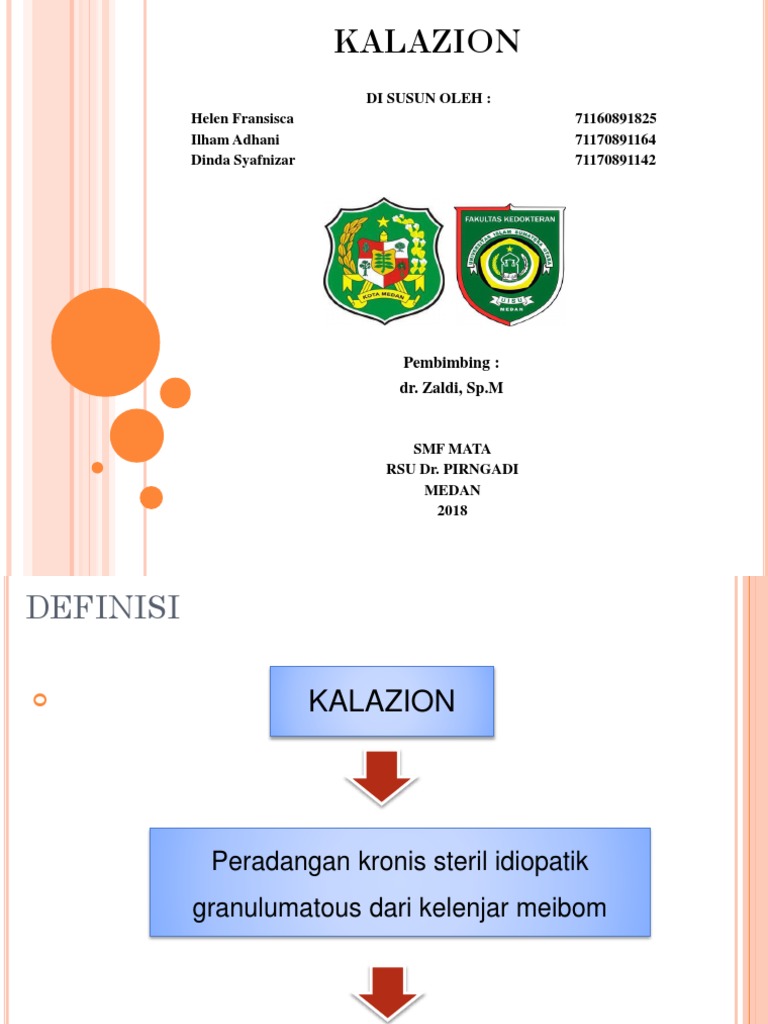 Kalazion | PDF