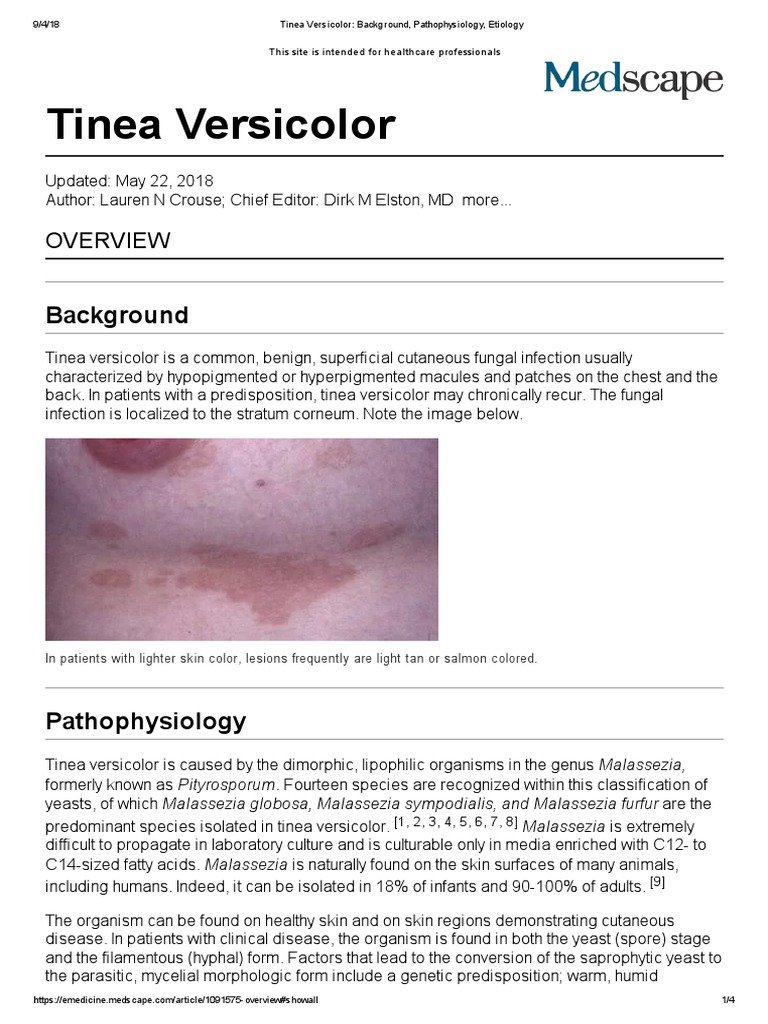 2 Tinea Versicolor - Background, Pathophysiology, Etiology | PDF ...