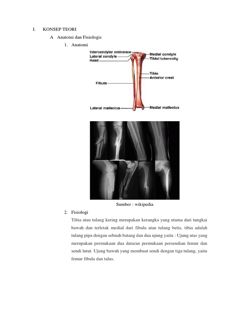 LP Open Fraktur Tibia | PDF
