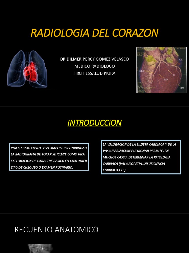 Radiologia Del Corazon | PDF | Corazón | Sistema cardiovascular