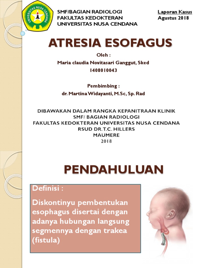 Atresia Esofagus | PDF