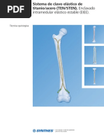 Placa Philos Técnica Cirúrgica | PDF | Tornillo | Cirugía