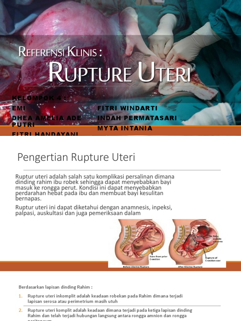 Ruptur Uteri: Penyebab dan Penanganan | PDF | Kesehatan Holistik ...