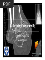 Chapitre 2 - Diagnostic D - Une Monoarthrite | PDF | Arthrose ...
