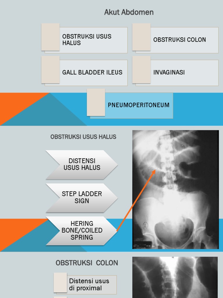 Abdomen X Ray Abnormal | PDF | Seni | Sains & Matematika