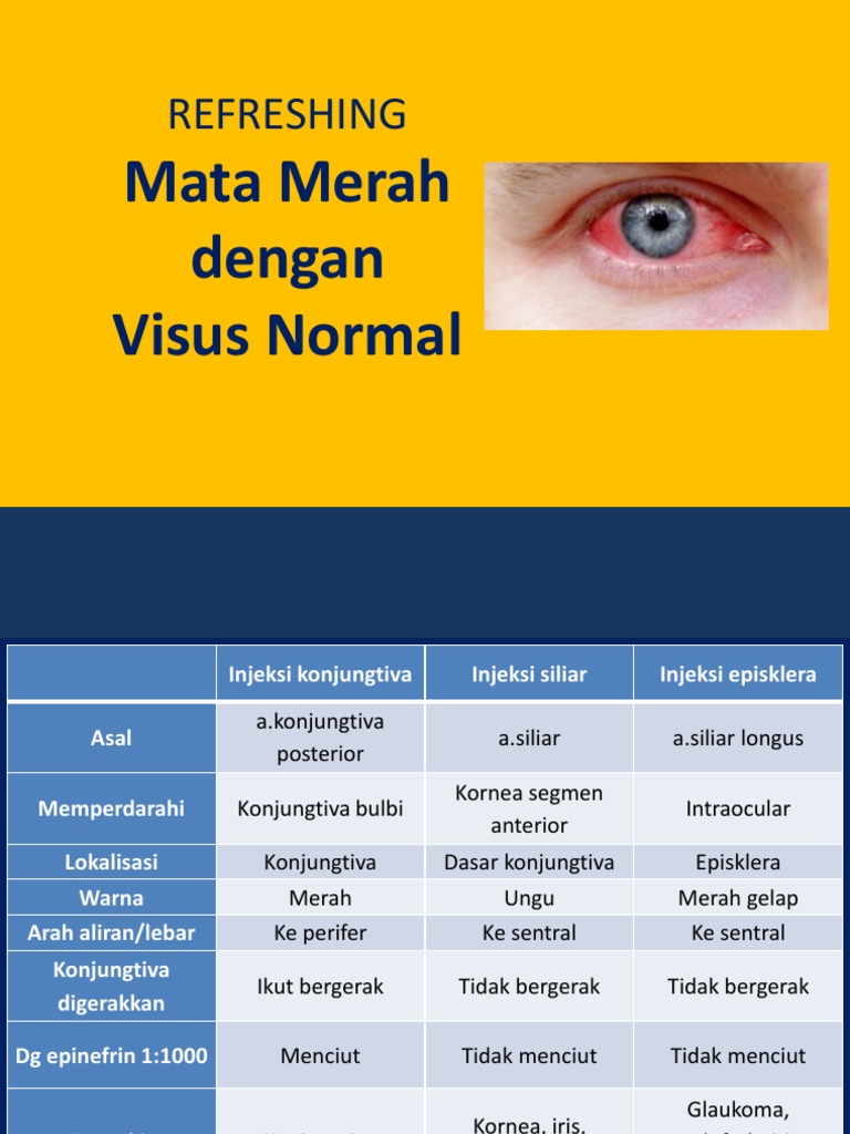 Mata Merah Visus Normal | PDF