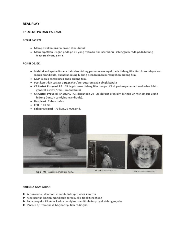 Teknik Radiografi Mandibula | PDF