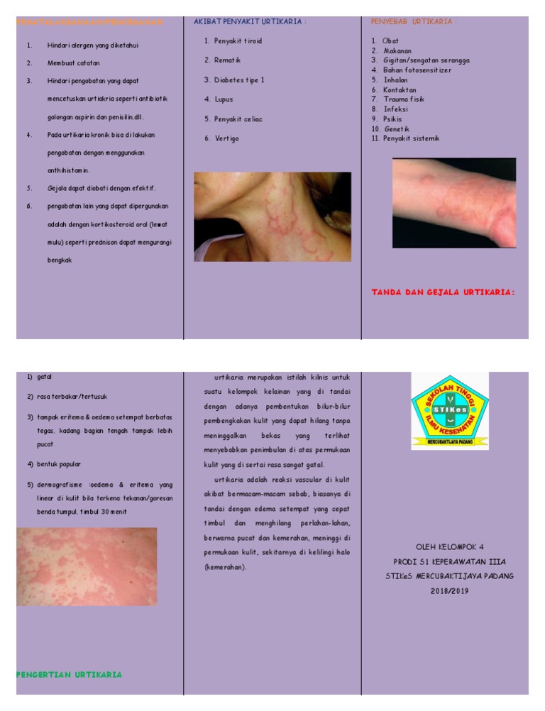 Leaflet Urtikaria | PDF