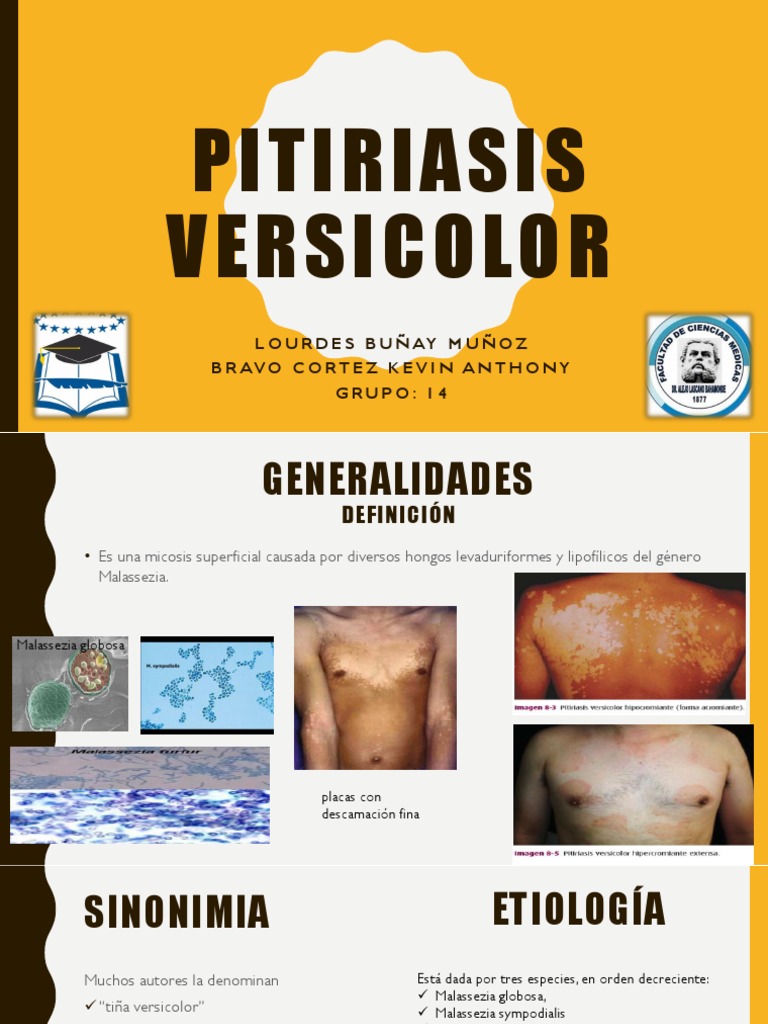 Pitiriasis Versicolor | PDF | Enfermedades y trastornos | Medicina