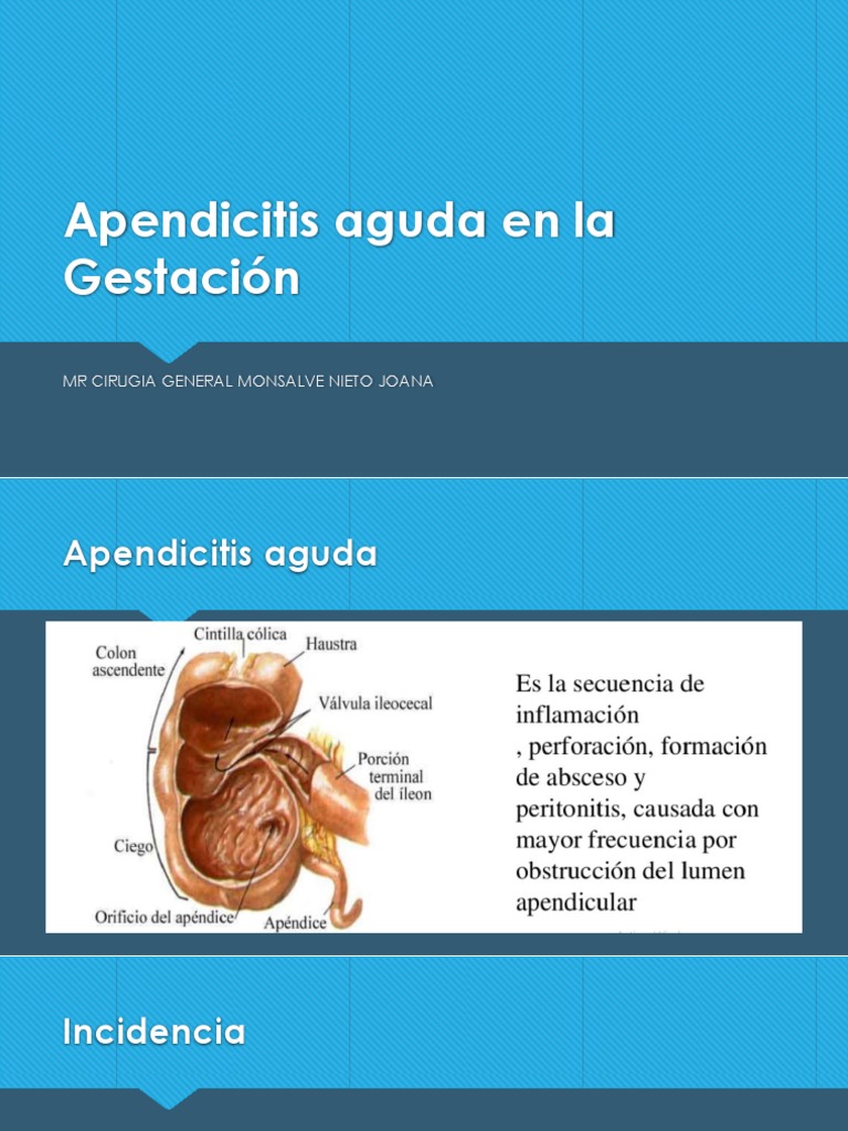 Apendicitis Aguda en Embarazo: Diagnóstico y Tratamiento | PDF ...