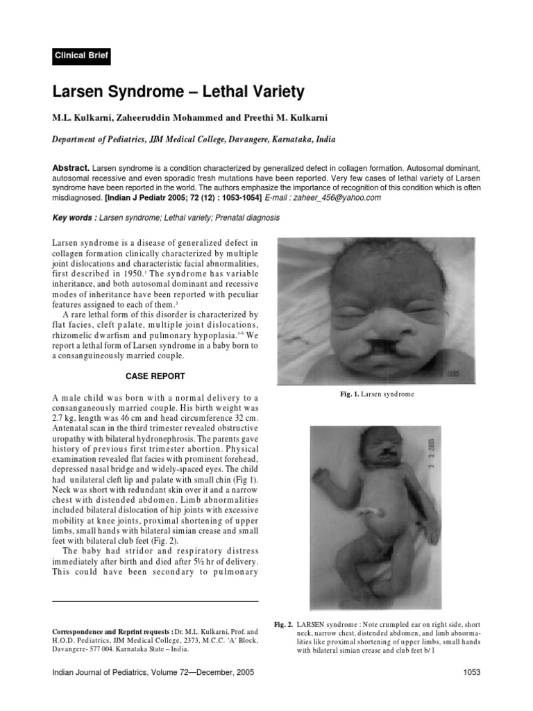 Larsen Syndrome - Lethal Variety: M.L. Kulkarni, Zaheeruddin Mohammed ...