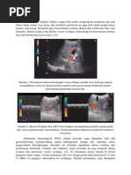 Contusio Musculorum | PDF