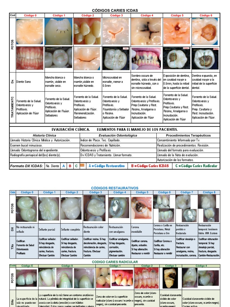 Clasificación y Códigos ICDAS en Odontología | PDF | Esmalte de dientes ...