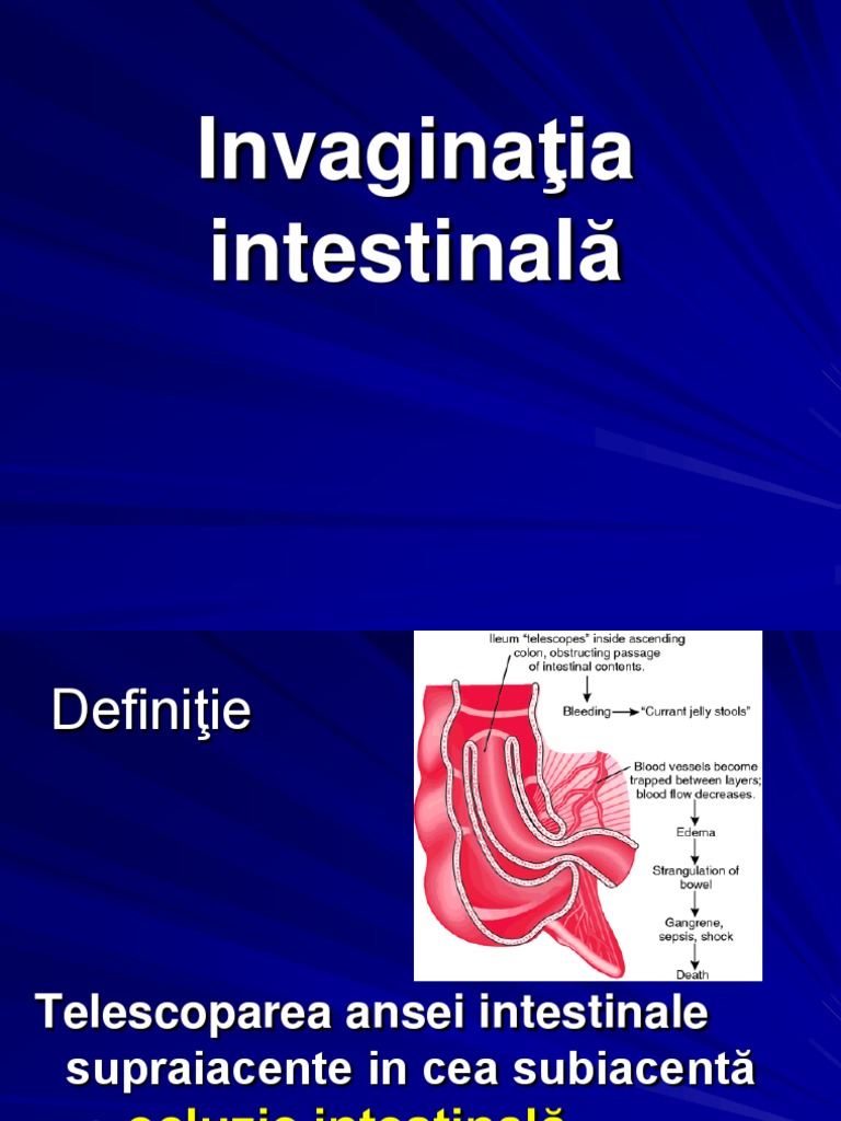 Invaginatie de Intestin | PDF
