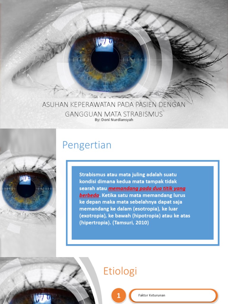 Asuhan Keperawatan Pada Pasien Dengan Gangguan Mata Strabismus | PDF