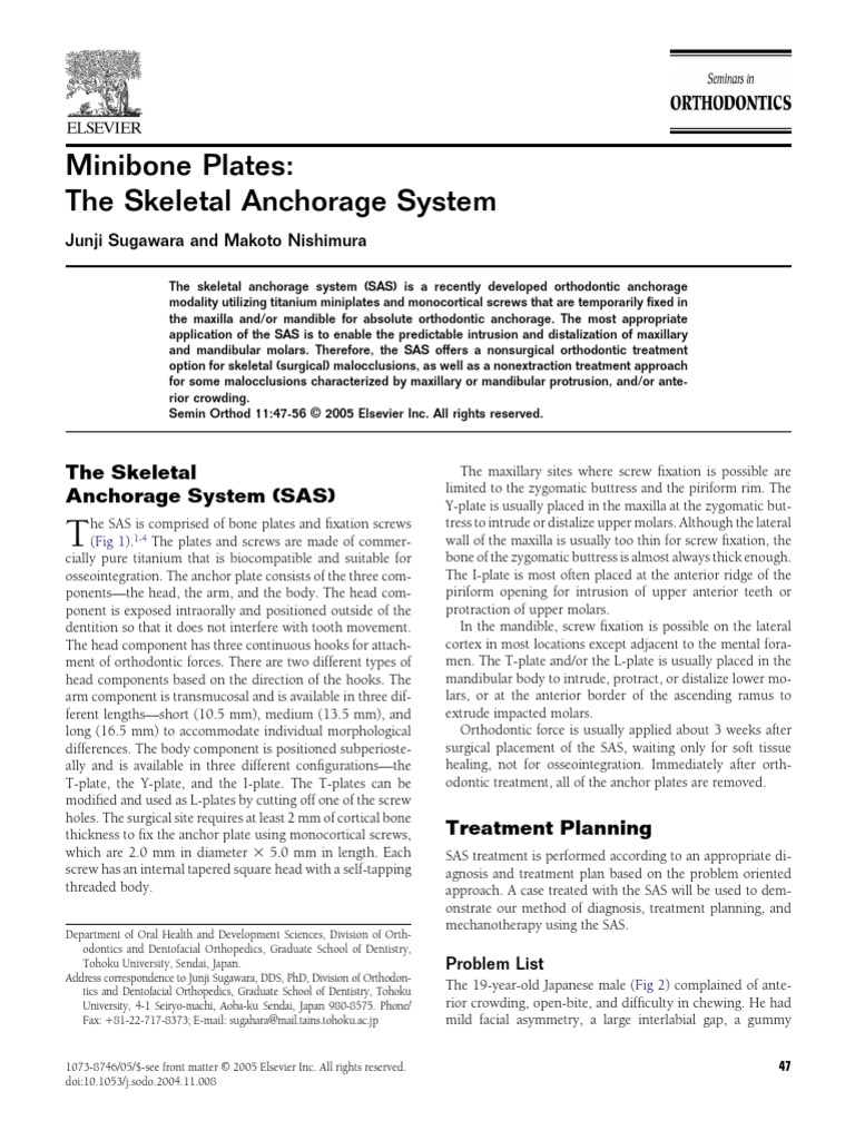 Minibone Plates - The Skeletal Anchorage System | PDF | Orthodontics ...