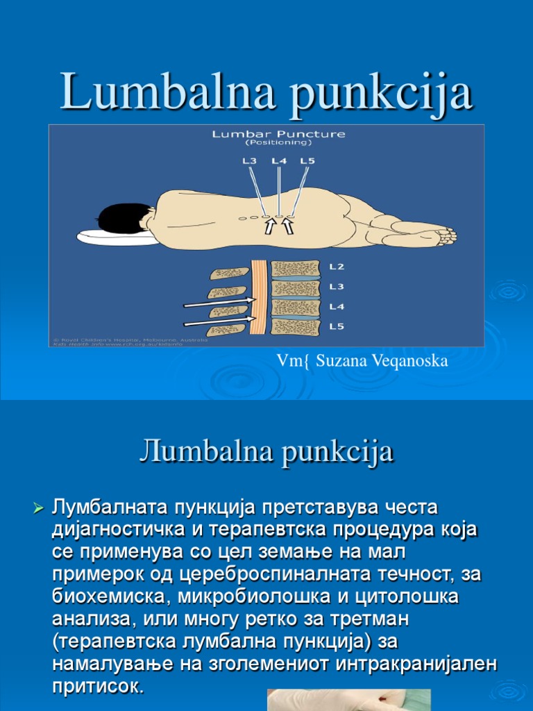 Lumbalna Punkcija 2010 | PDF