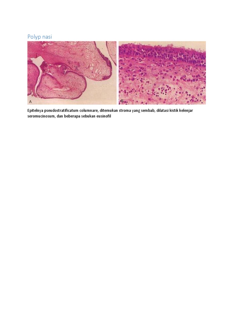 Normal Histology of Breast Tissue Consists of The Lobules | PDF