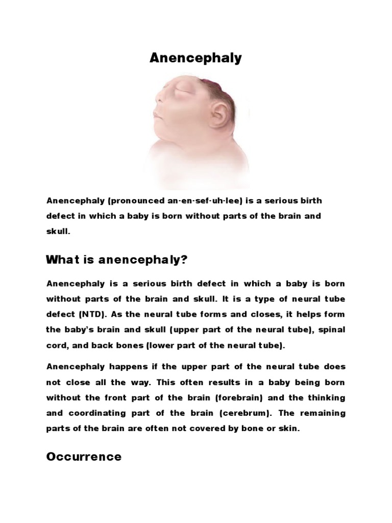 Anencephaly | PDF | Science & Mathematics
