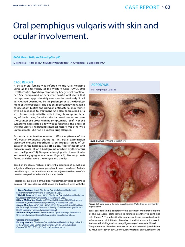 Pemphigus Vulgaris | PDF | Medicine | Diseases And Disorders