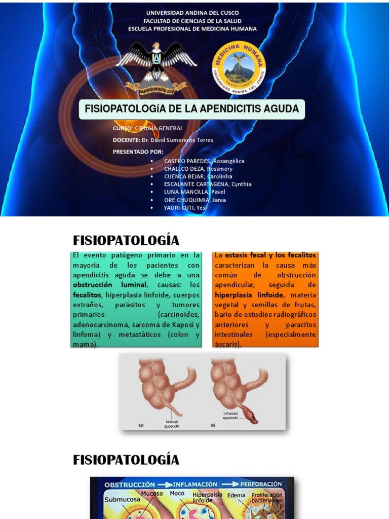 FisiopatologÍa de La Apendicitis Aguda | PDF | Inflamación | Serotonina