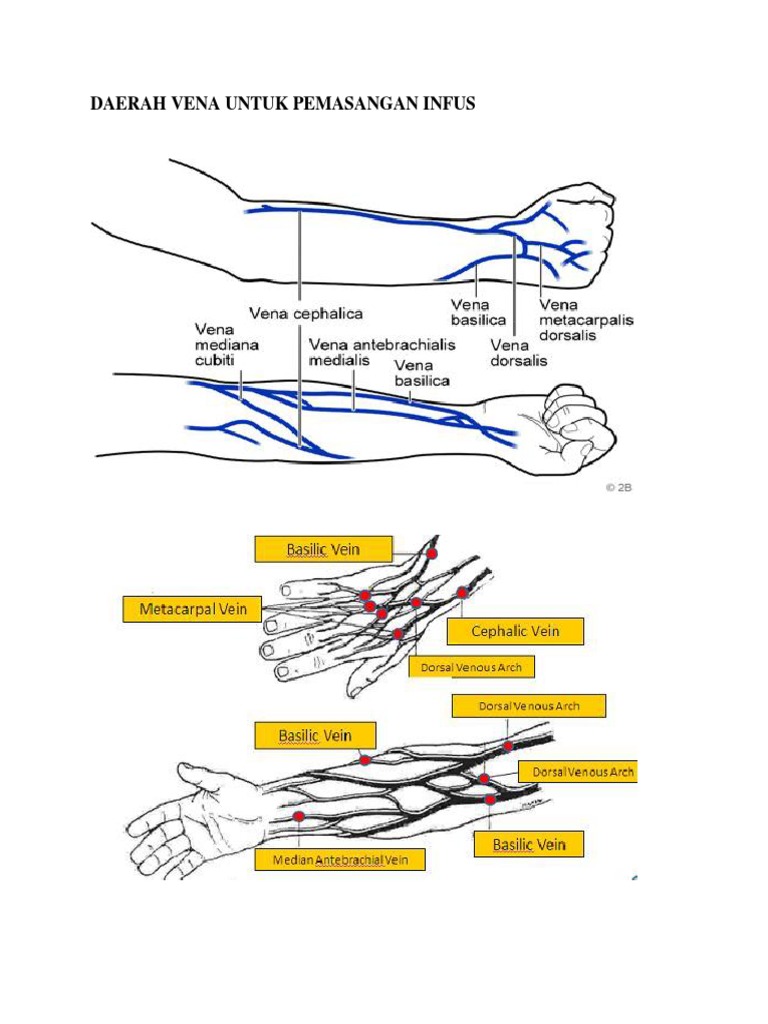 Daerah Vena Untuk Pemasangan Infus | PDF