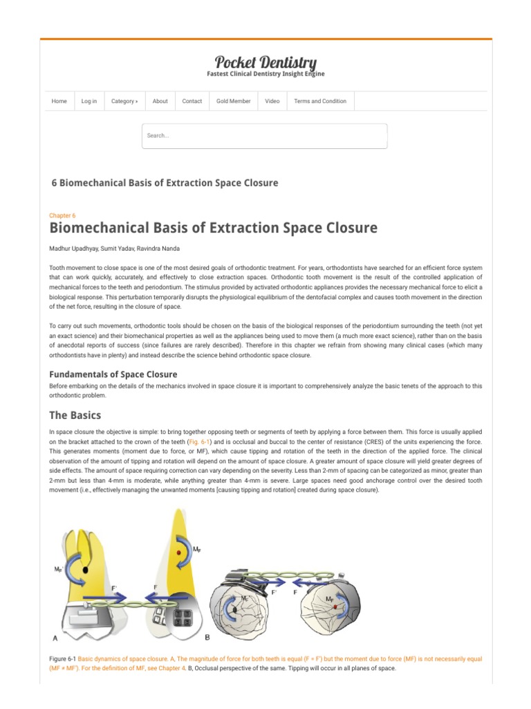 6 Biomechanical Basis of Extraction Space Closure - Pocket Dentistry ...