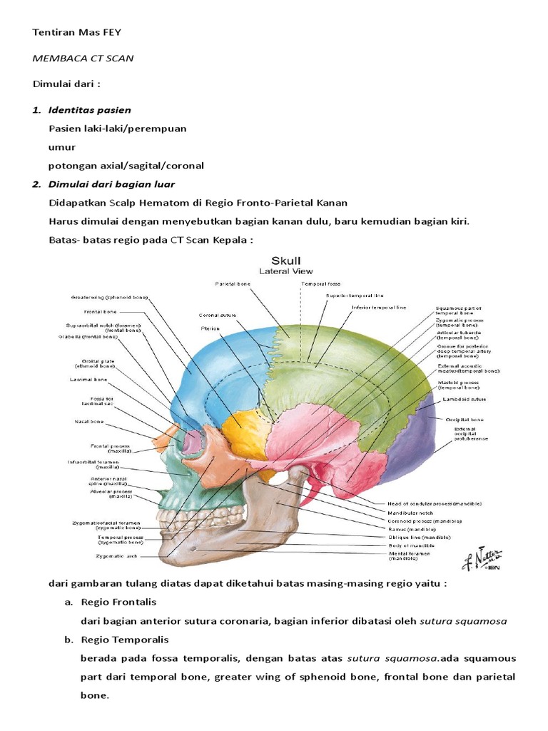 Sistematika Membaca Ct-Scan | PDF