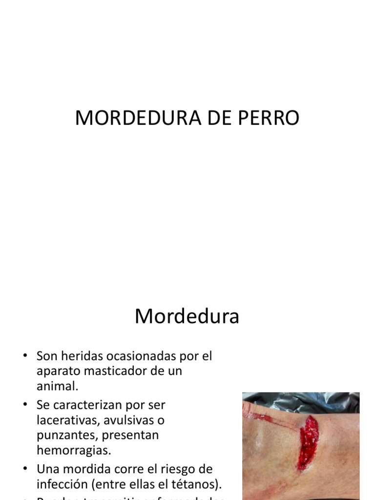 Mordedura de PERRO | Rabia | Especialidades Medicas