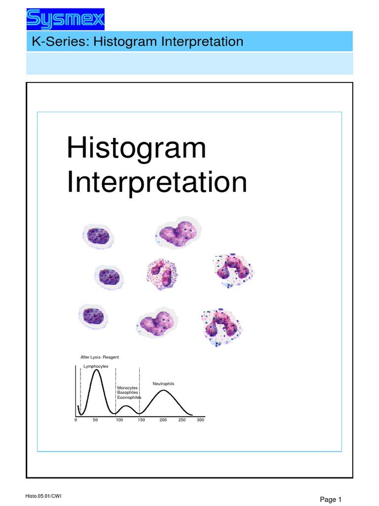 Sysmex KX 21 Histogram Interpretation Handbook | Anemia | White Blood Cell