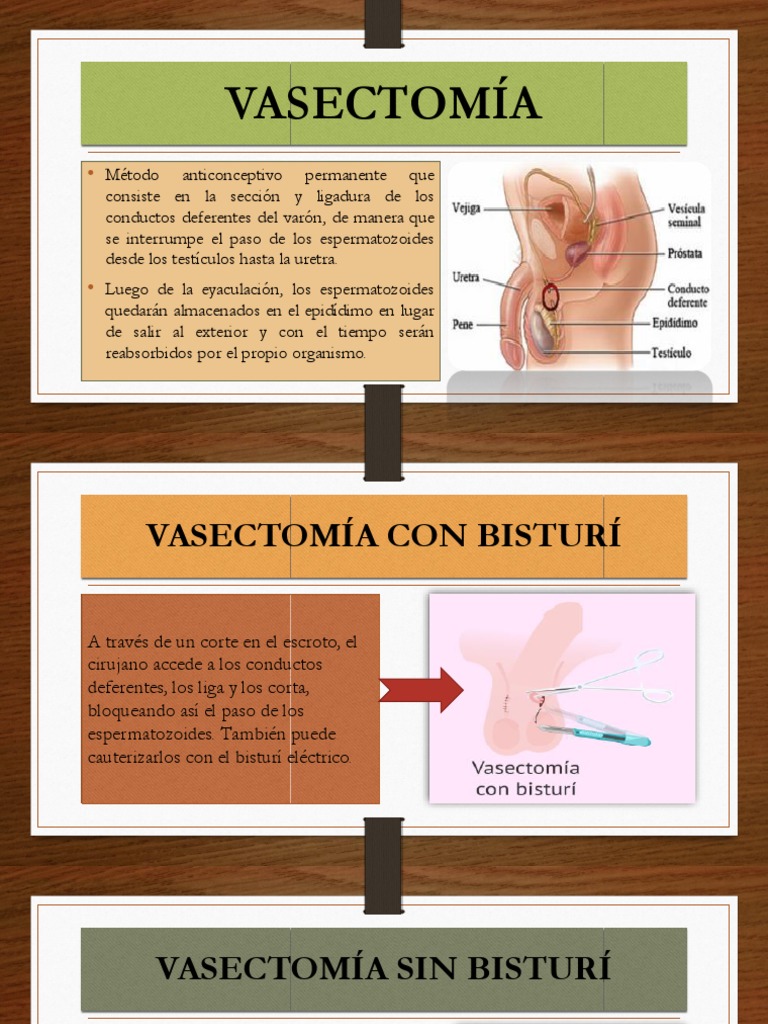 Vasectomía: Método Anticonceptivo Permanente | PDF | Anatomia sexual ...