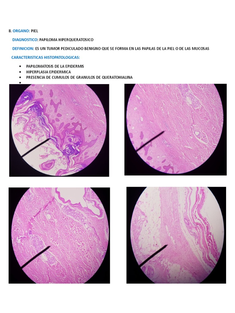 PRACTICA 33 Patologia 1 | PDF
