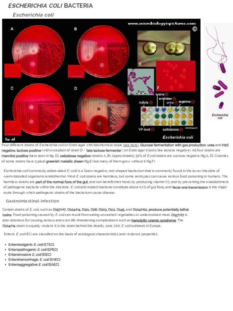 E Coli | PDF | Urinary Tract Infection | Escherichia Coli