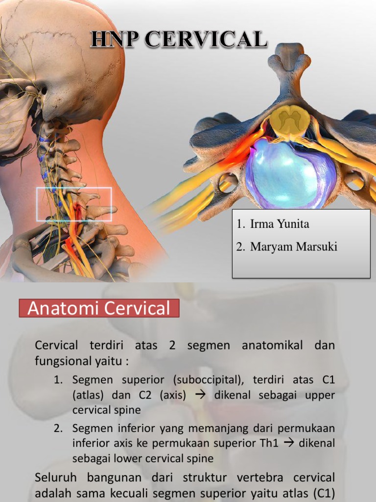 Ppt Hnp Cervical