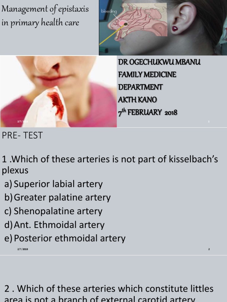 Management of Epistaxis in Primary Health Care: DR Ogechukwu Mbanu ...