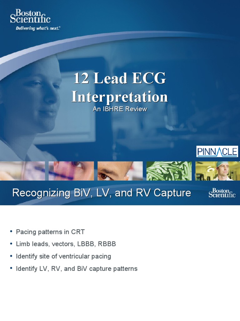 12 Lead Interpretation | PDF | Electrocardiography | Artificial Cardiac ...